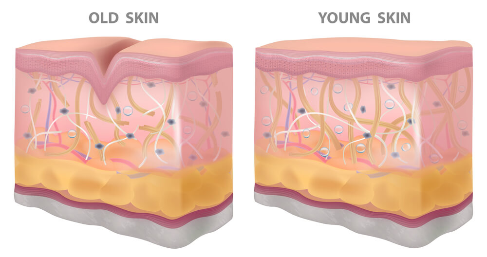 Importance of Elastin & Top Steps to Support Your Skin's Elasticity ...